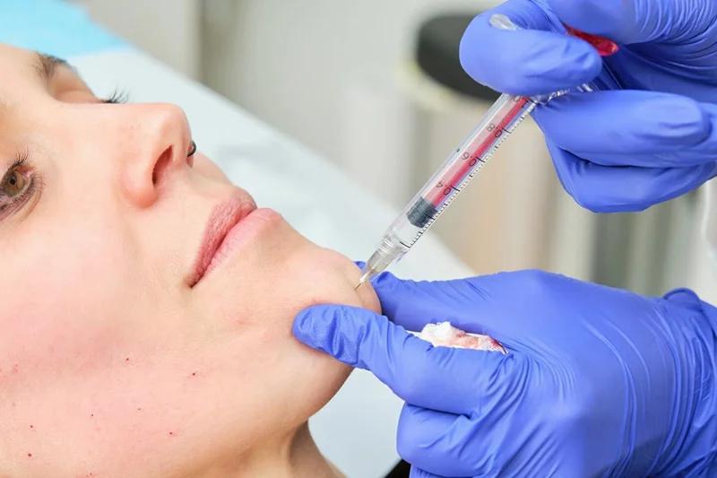 Botox in Chin Before and After: Complete Guide