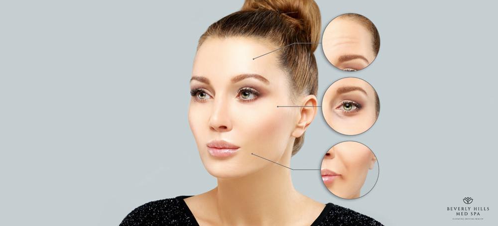 Botox on Eyelids Before and After: Transformative Effects Explained