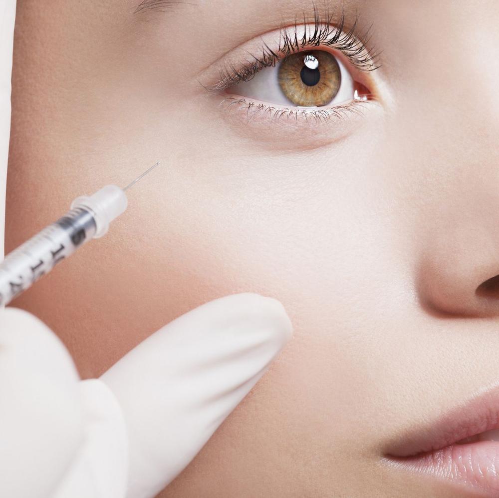 Botox for Under Eye Wrinkles When Smiling Before and After: A ...